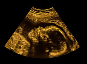 What are the most important influences on brain development before ...