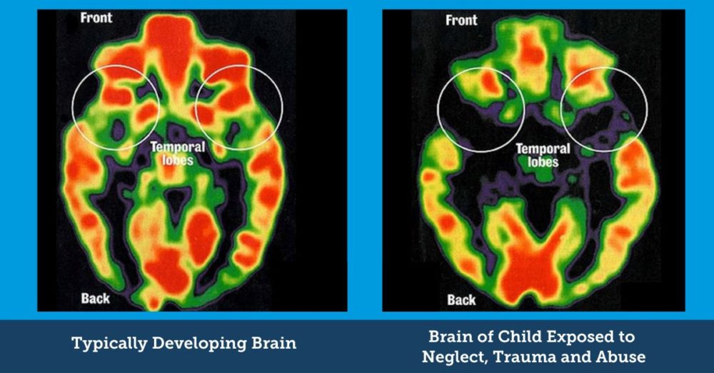 What does trauma do to a baby’s brain? | ZERO TO THREE