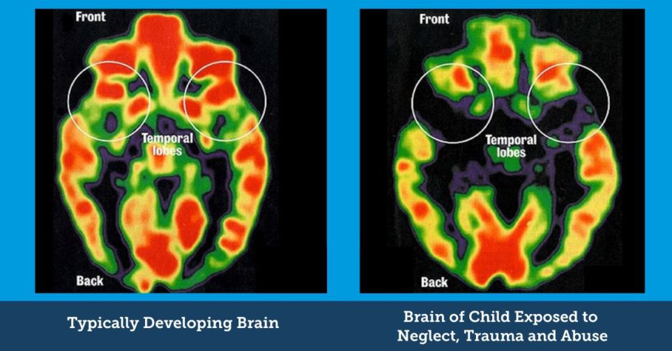 What does trauma do to a baby’s brain? | ZERO TO THREE